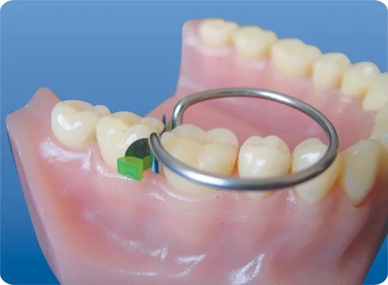 Shop Russia Tor Vm Sectional Contoured Matrices Kits - Best Sectional ...