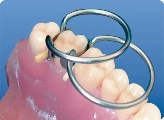 Buy Russia Tor VM Dental Rings | VM Rings for Superior Contac