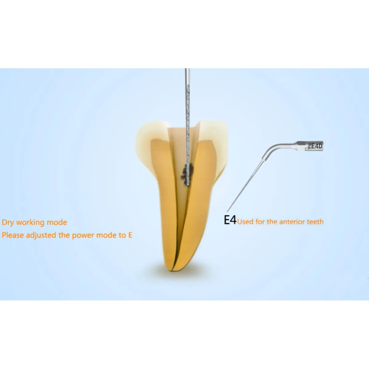 Woodpecker Scaler Tip - E4D