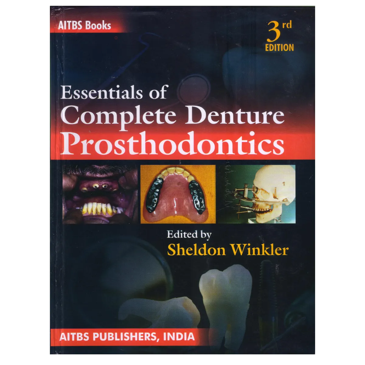 Essentials Of Complete Denture Prosthodontics 3th Edition (ISBN ...