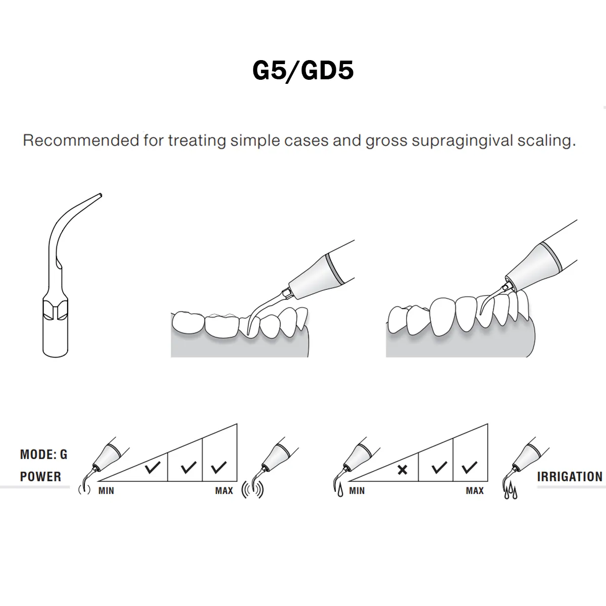 Woodpecker Scaler Tip GD5