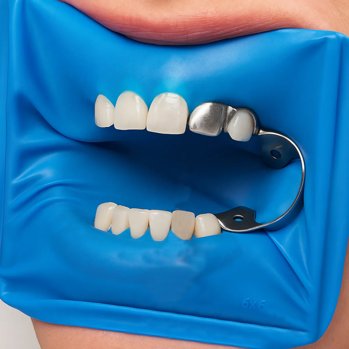 Buy 4D Rubber Isodam Non-Latex Polyisoprene Dental Dam Blue - Medium (6 ...