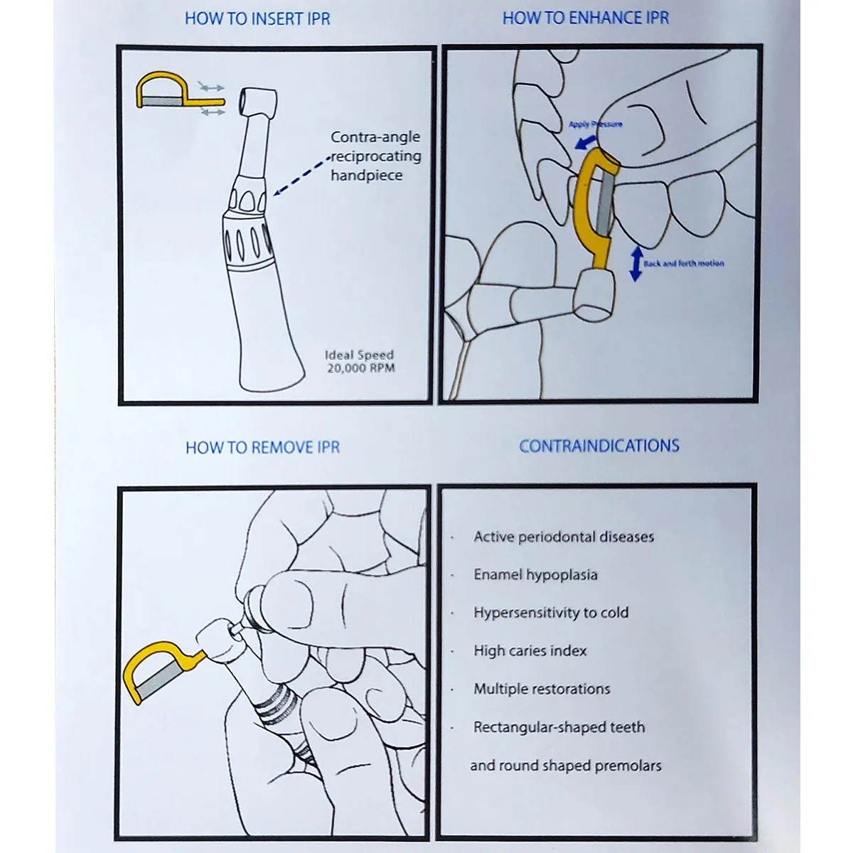 Sawbros Orthodontic IPR Blades set + Manual Handle Straight Online at ...