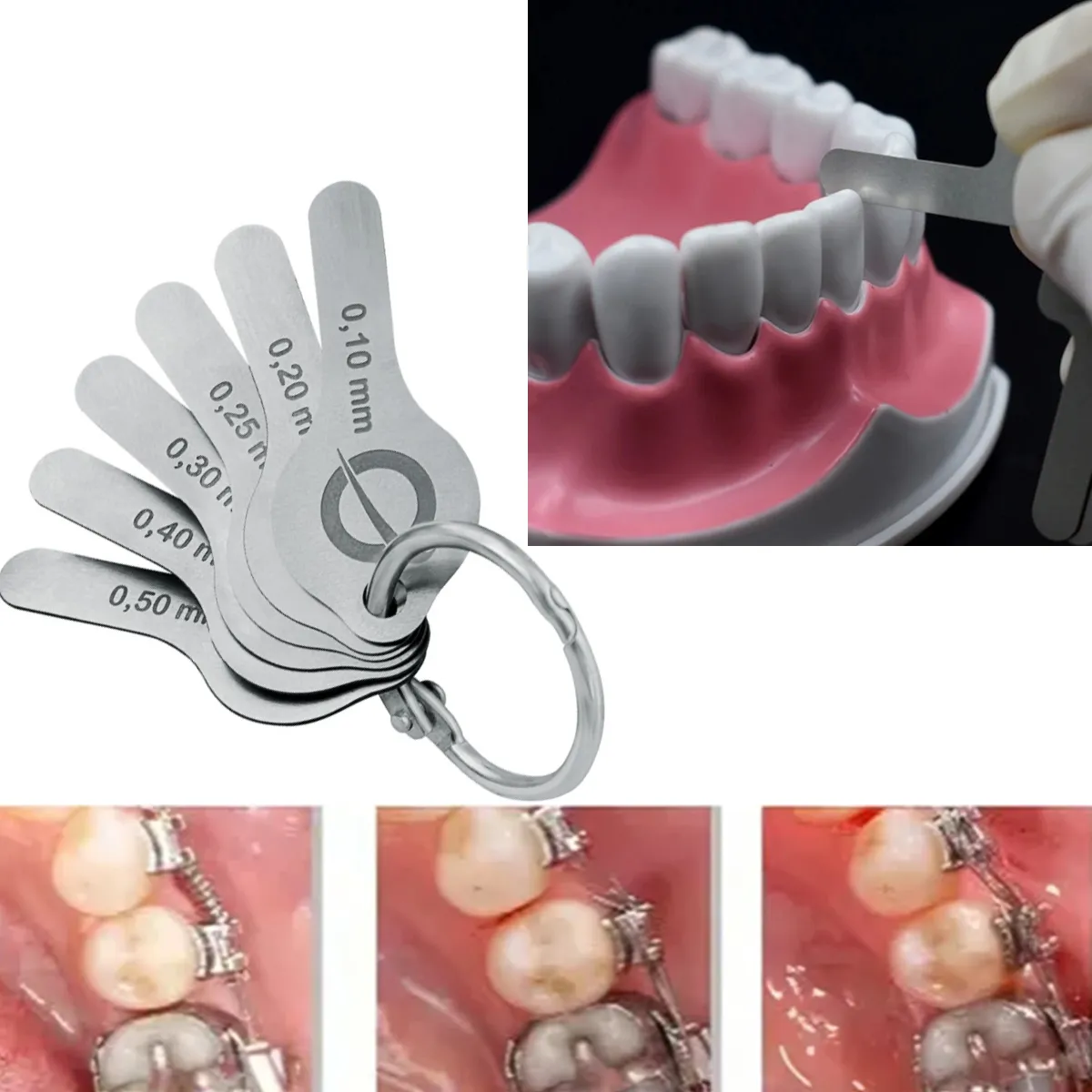 OrthoMetric Interproximal Space Gauge - (75.00.0017)