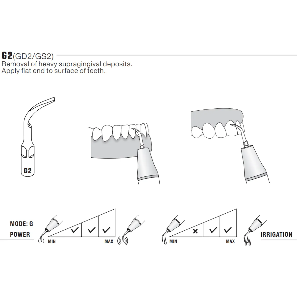 Buy Woodpecker Scaler Tip G2 for UDS & EMS Scalers | Dentalkart