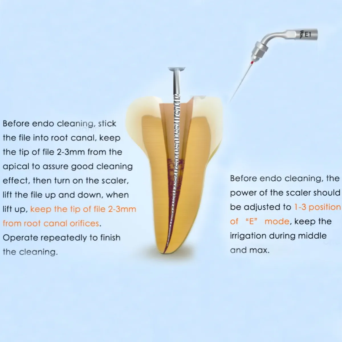 Woodpecker Scaler Tip E1 for UDS & EMS Scalers Online at Best Price ...