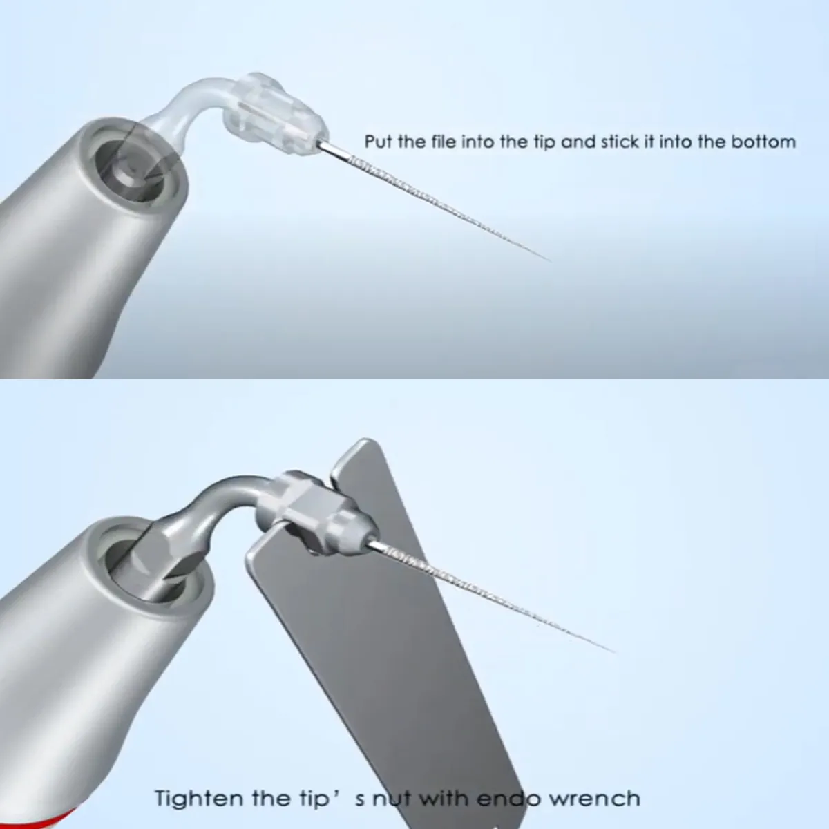 Woodpecker Scaler Tip E1 for UDS & EMS Scalers Online at Best Price ...