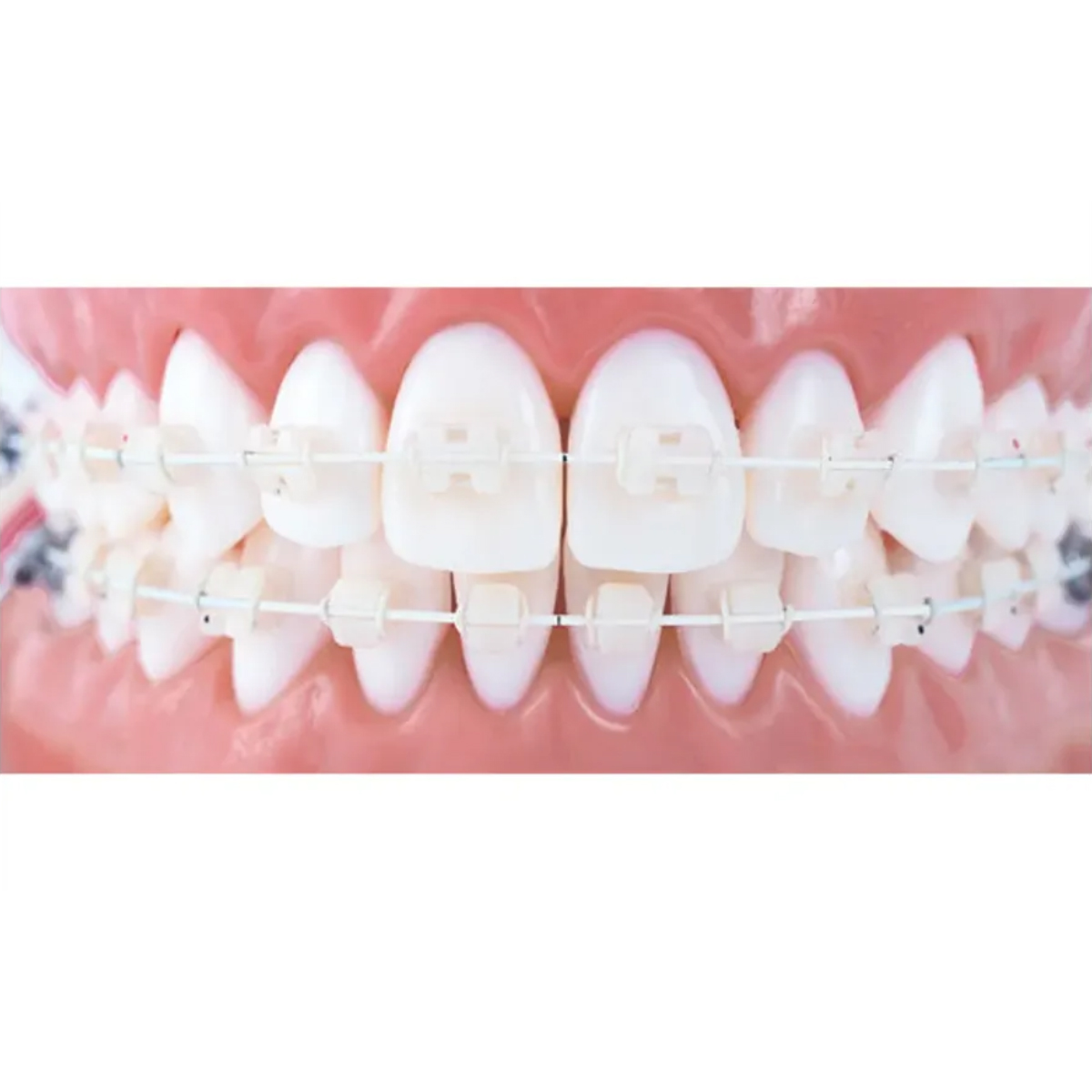 OSL NiTi Tooth Color Ovoid Form - Rectangular (Pack Of 5)