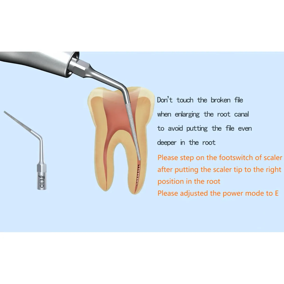 Woodpecker Scaler Tip - E3D