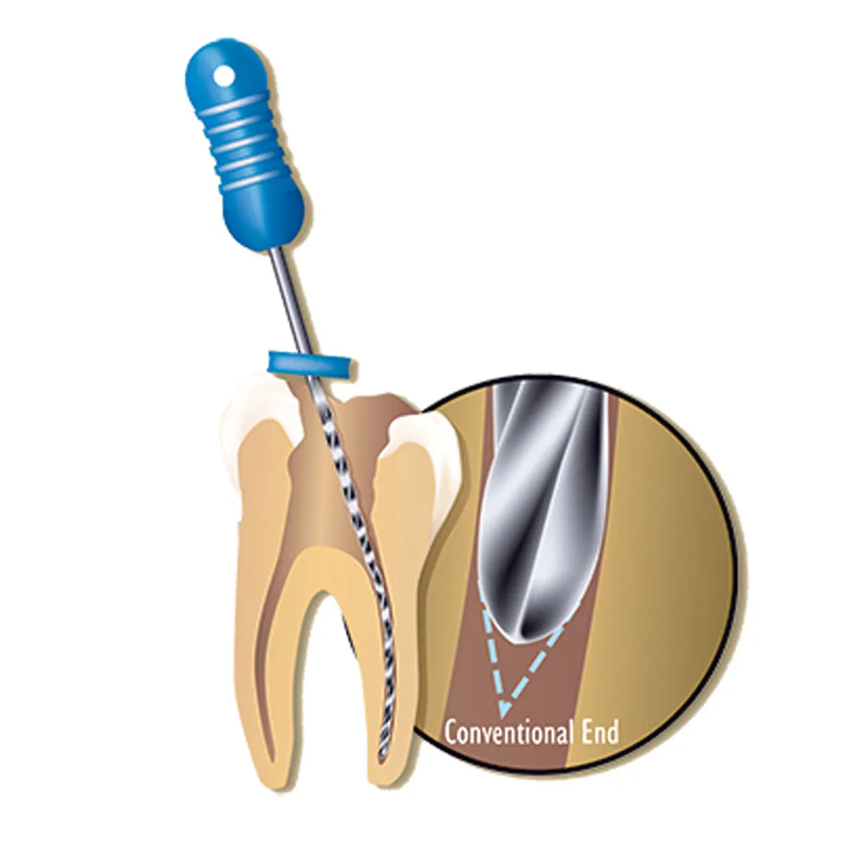 Mani K-Files 25mm at Best Price | DentalKart