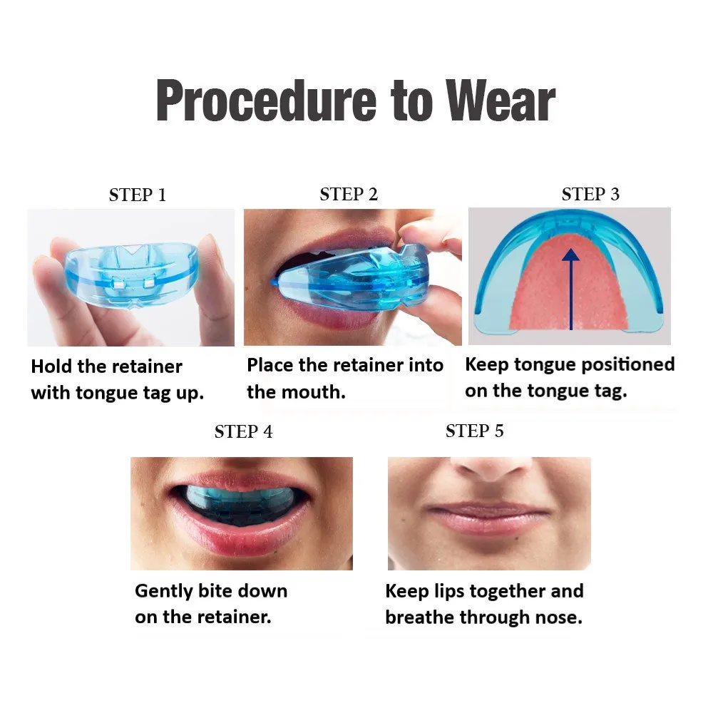 Buy U Ortho Retainers - Best Retainers Online | Dentalkart