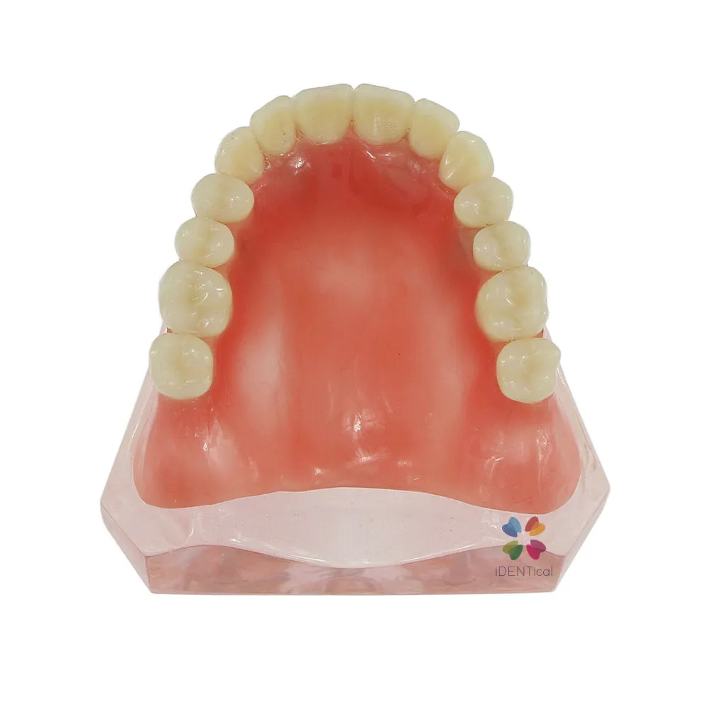 Buy iDENTical Overdenture Maxilla Model M6001:with Edentulous Solutions ...