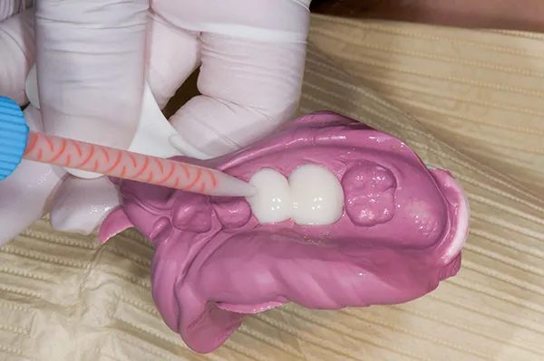 Coltene Whaledent Cooltemp Natural | Dentalkart