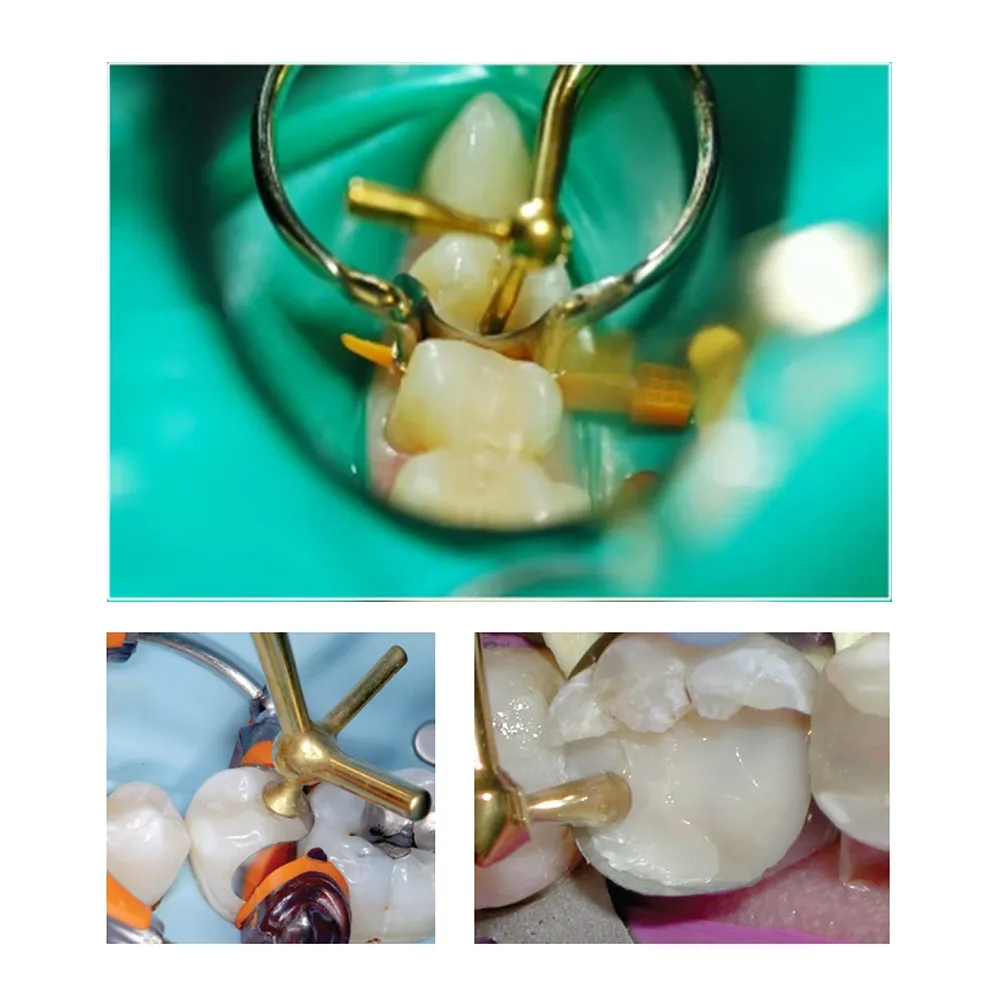 Waldent Composite Instrument Titanium Nitride Coated