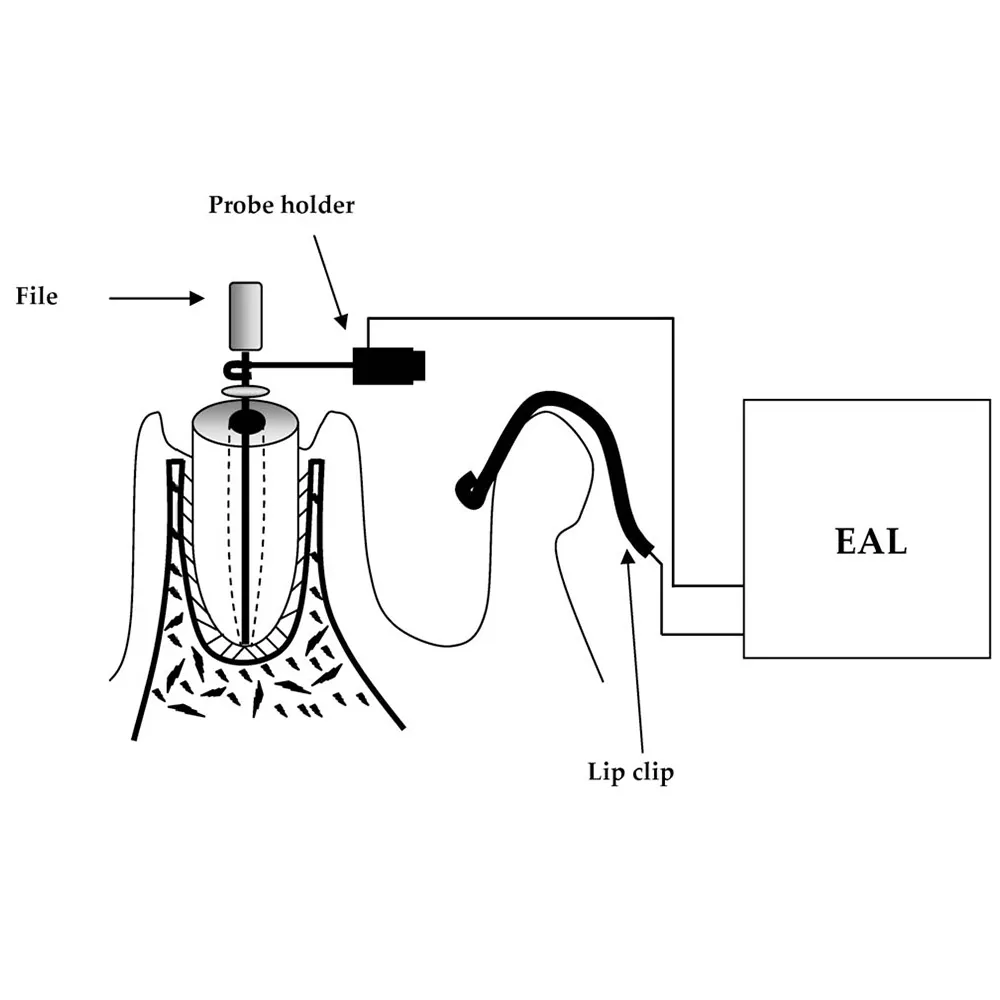 Woodpecker Apex Locator Accessories