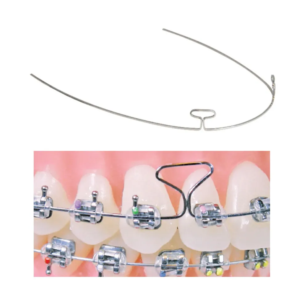 Aditek SS T-Loop Wires Trueform