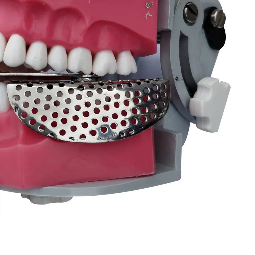 Waldent Perforated Rim Lock Half Impression Trays