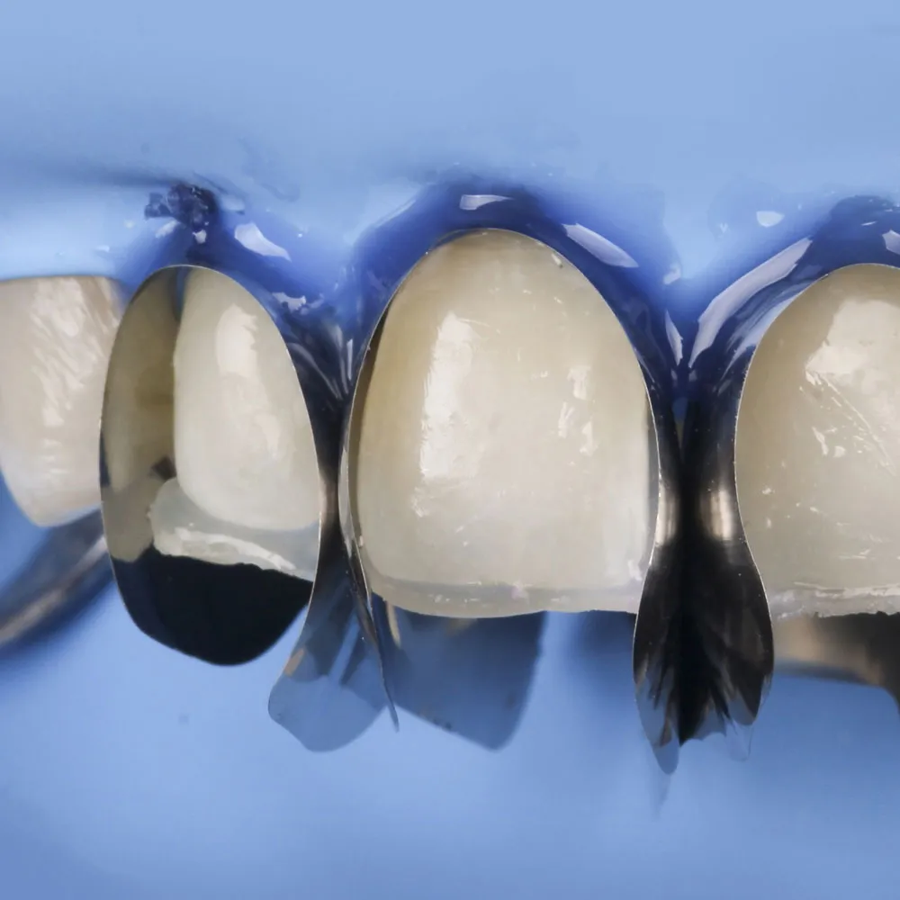 Polydentia Unica Anterior Matrix System Intro Kit