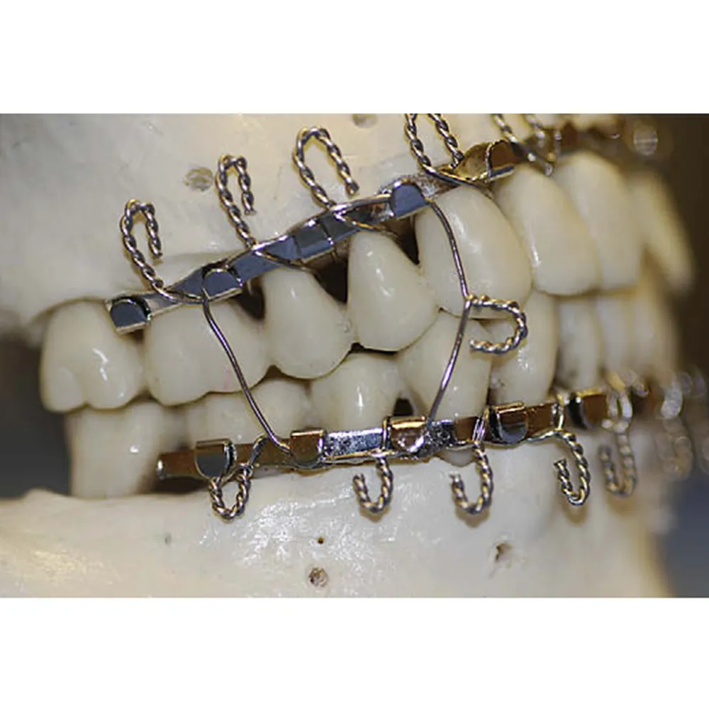 GI Orthotec Erich Archbar Online at Best Price | Dentalkart.com