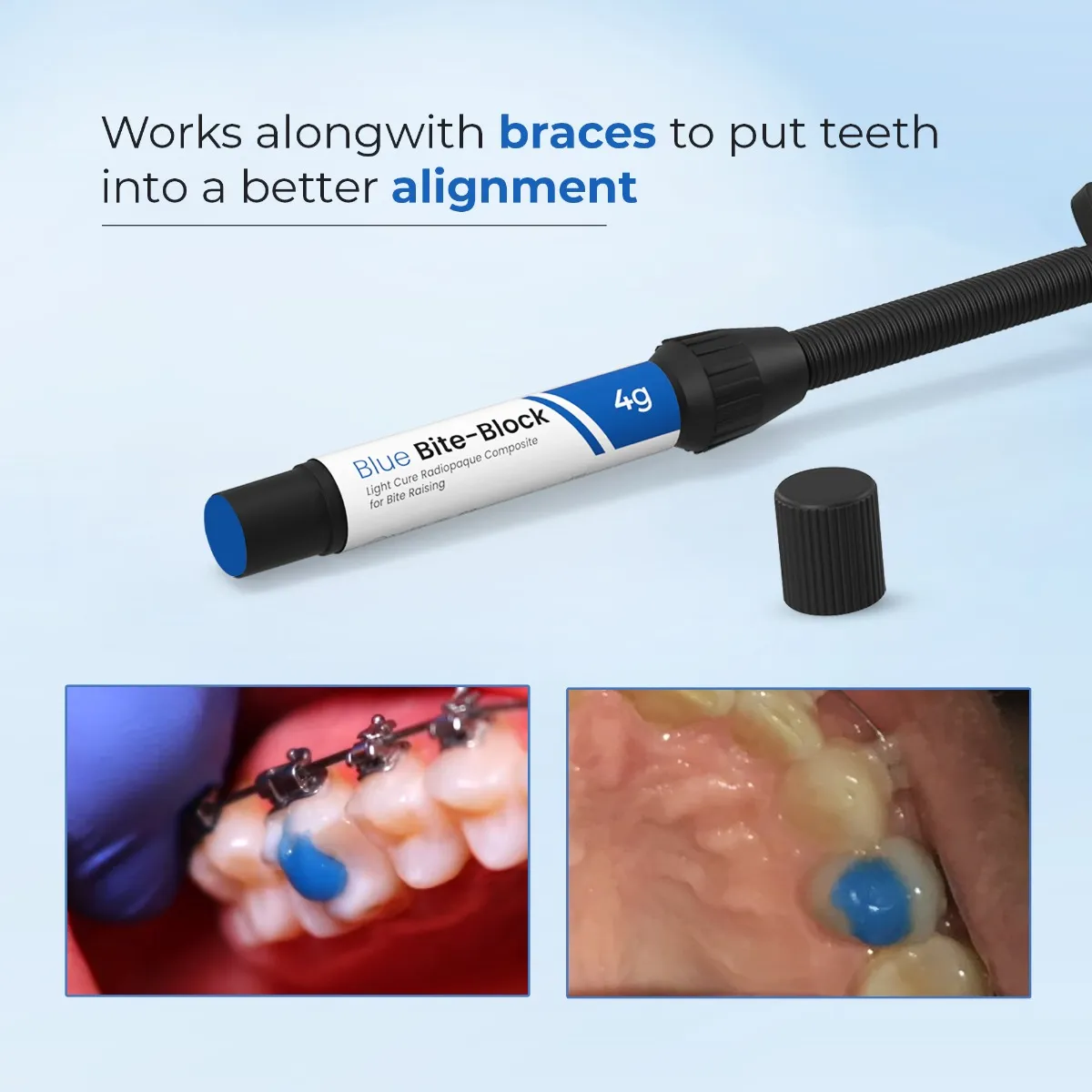 Waldent Blue Bite-Block | Dentalkart