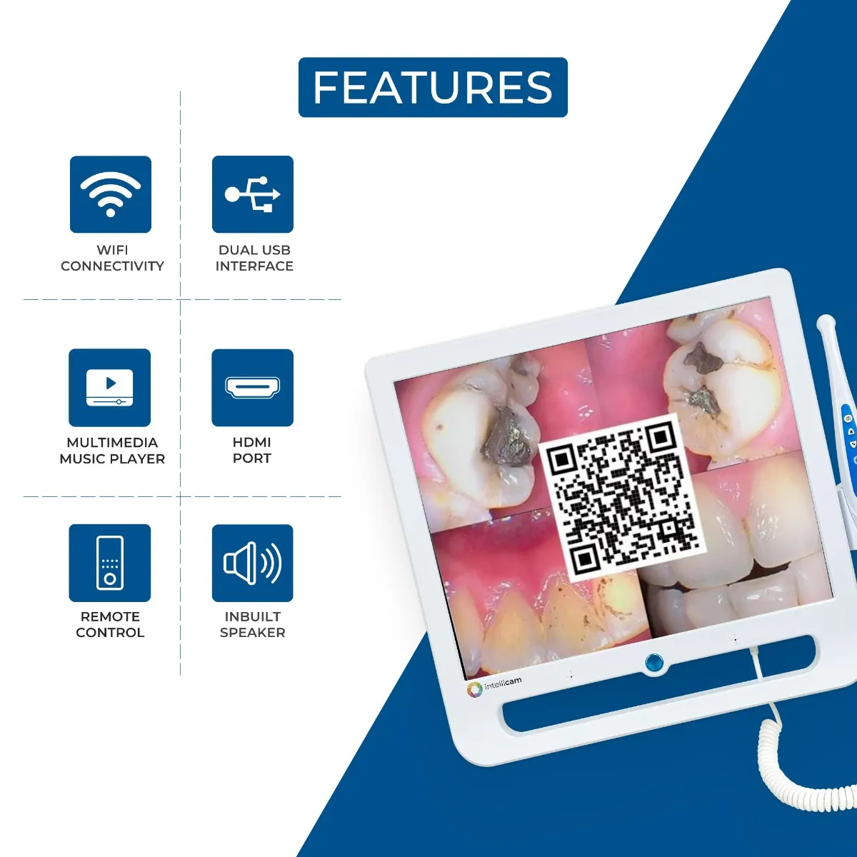 Buy Intellicam 16 Intraoral Camera | Ultra HD, Wide Focus, Auto Backup ...