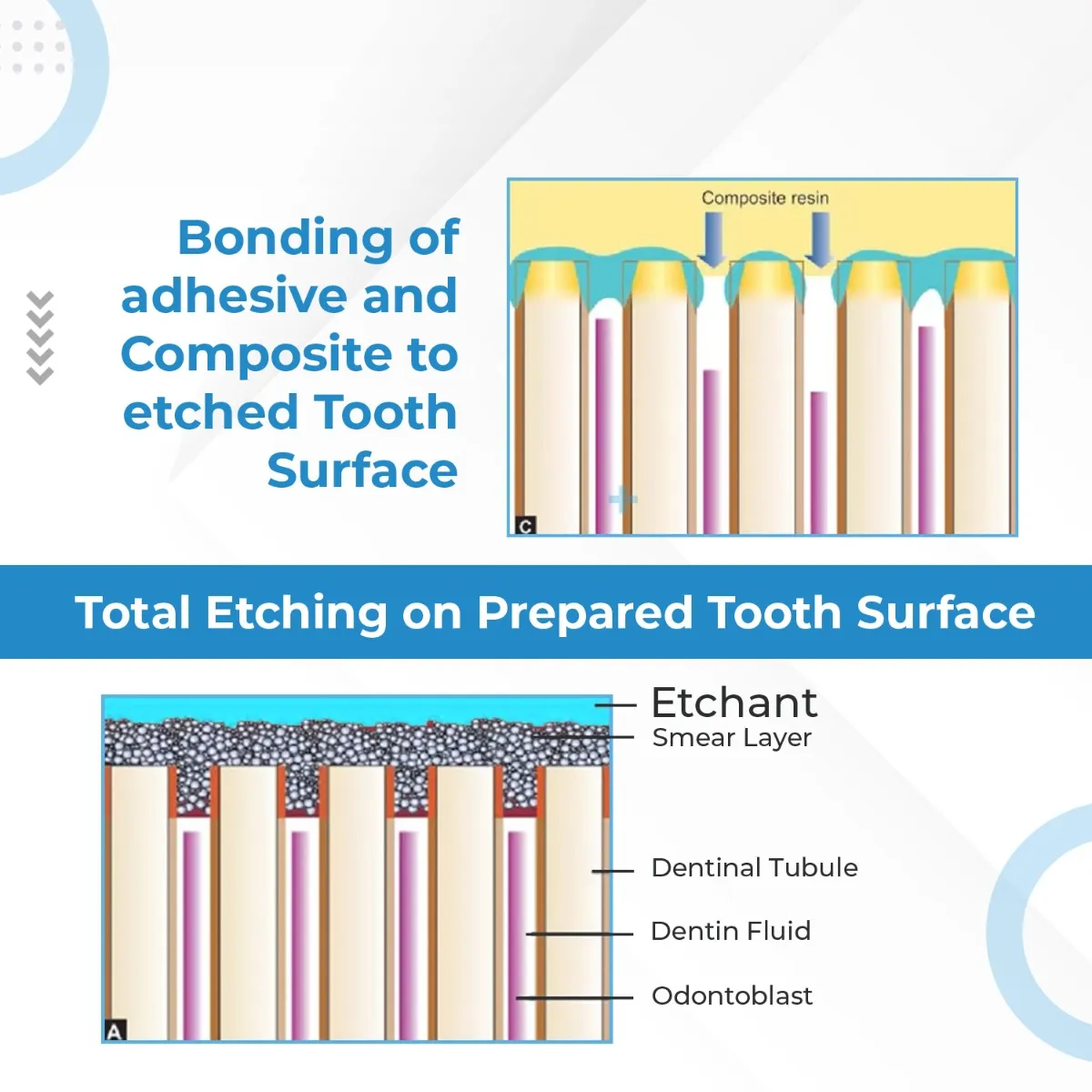 Buy Waldent Best Etch Toothpaste for Effective Etching Dentalkart