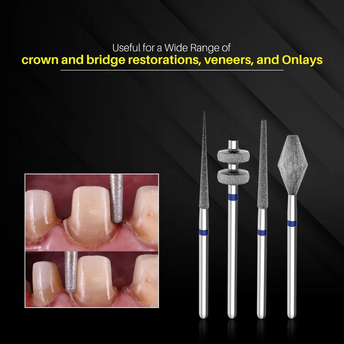 Buy Diamond Burs Online | Best SuperEndo Crown Preparation Bur Kit ...