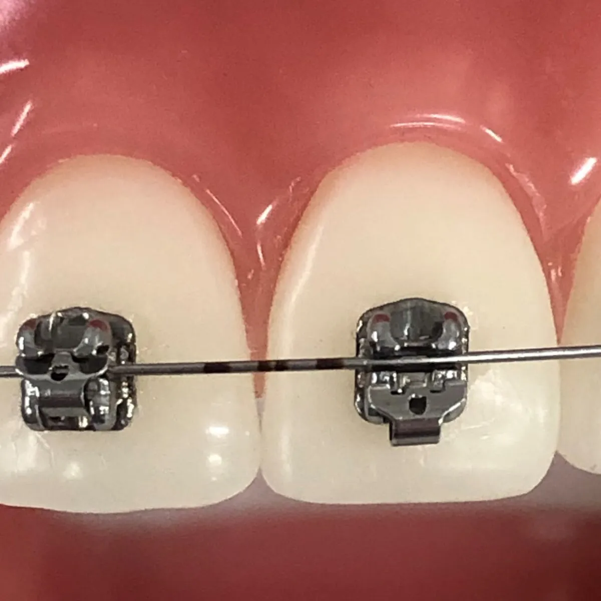 JJ Ortho Superelastic NiTi Archwires Natural Form - Rectangular