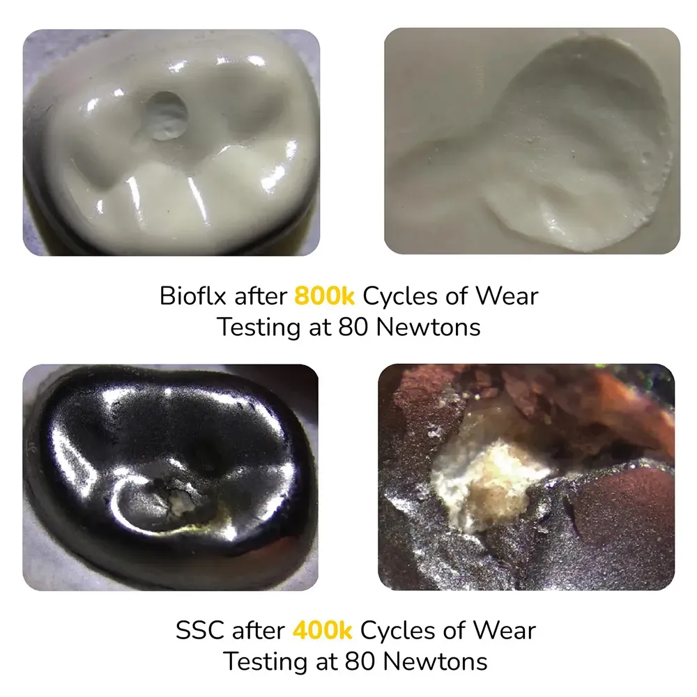 Buy Kids-e-Dental BioFlx Lower Left 2nd Molar Crowns | Dentalkart