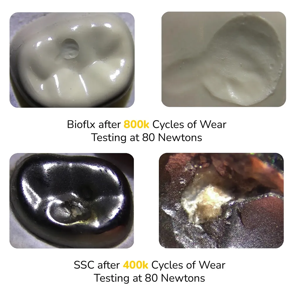 Kids-e-Dental Bioflx Posterior Crown Kits