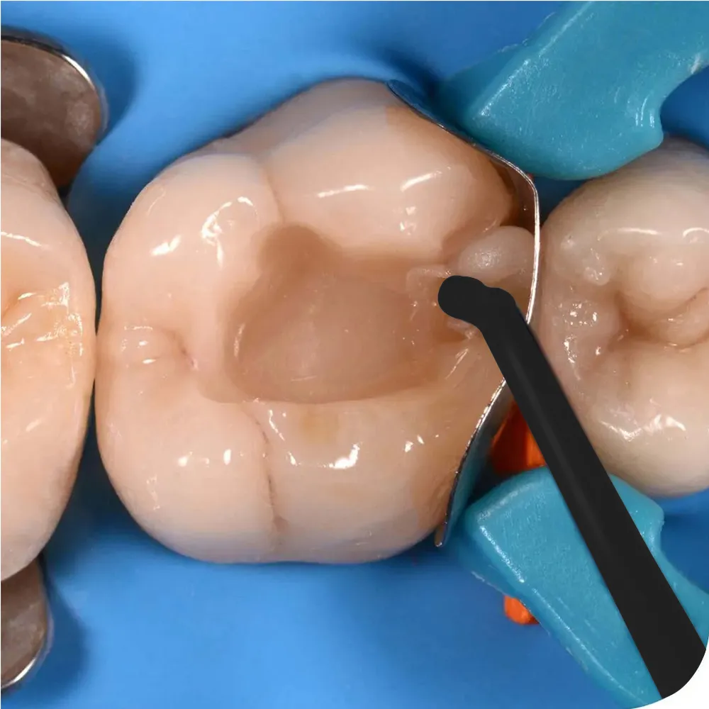 Buy GDC Teflon Coated Composite Instrument Posterior Set Of 5 Pcs ...