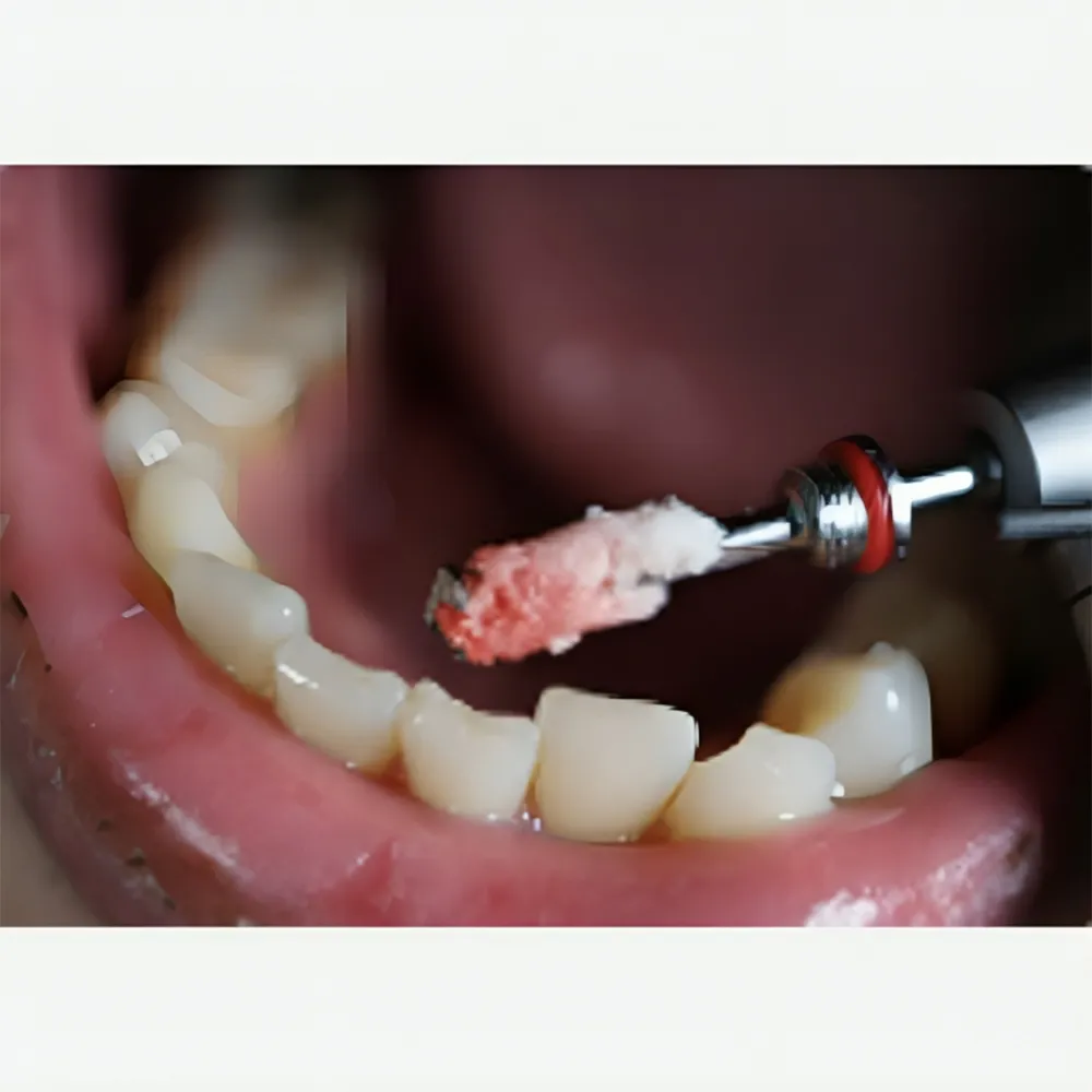 MCTBIO Bone Chip Maker-2 (BCM2-01)