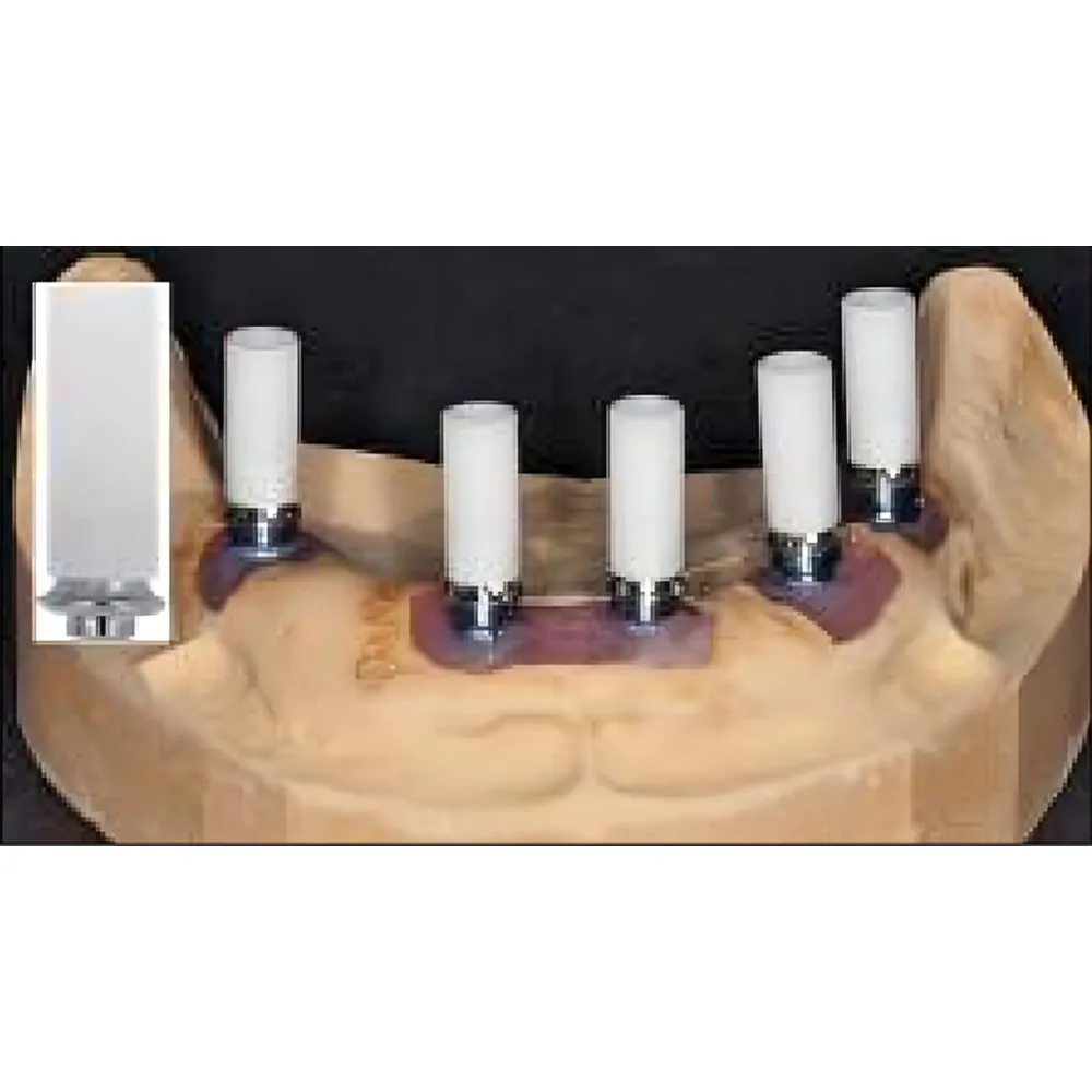 Adin NP Engaging Plastic Cylinder Casting Abutment (NP0045)