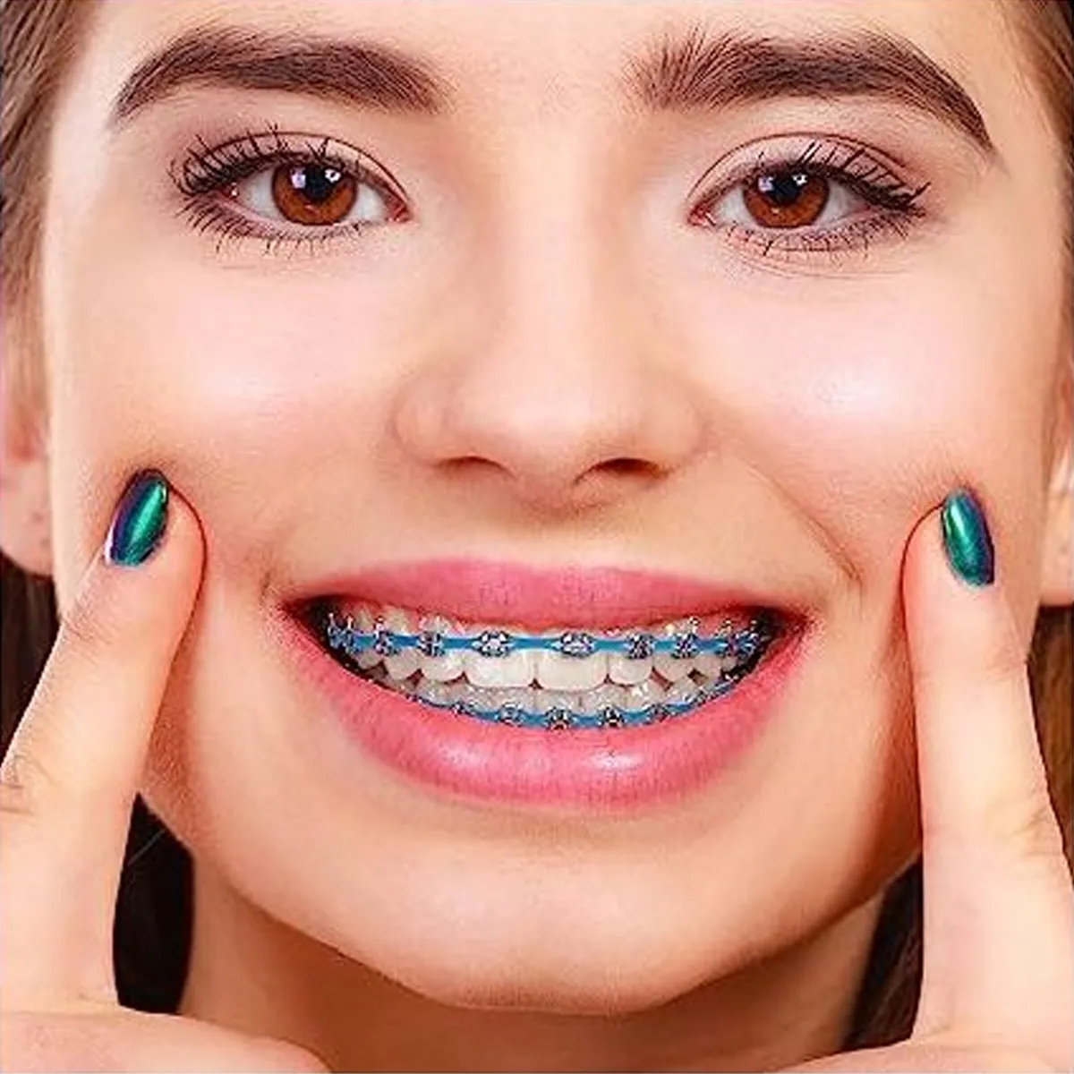 OrthoMetric E-Chain 15 Ft