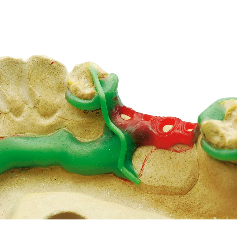 Buy Maarc Clasp Profile Waxes - Best Dental Wax - Dentalkart