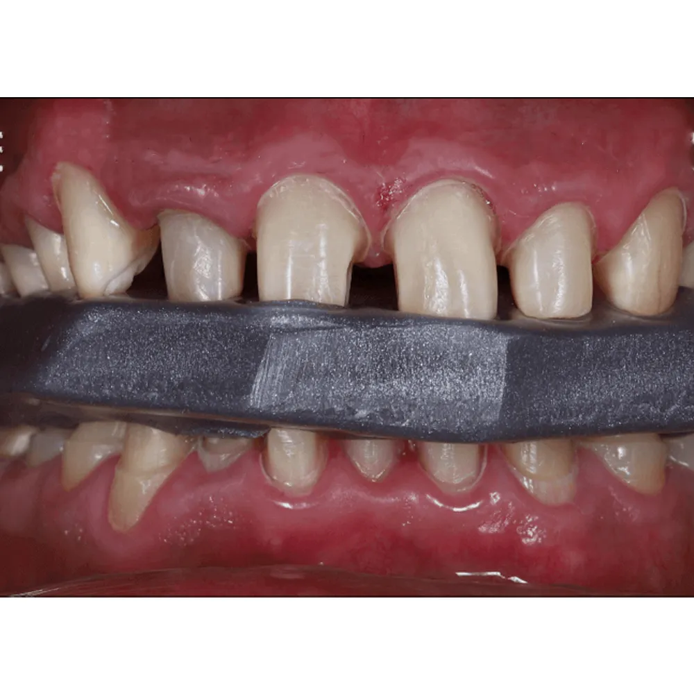 Buy MAARC Classic Bite Registration Wax Extra Hard | Dimensionally ...