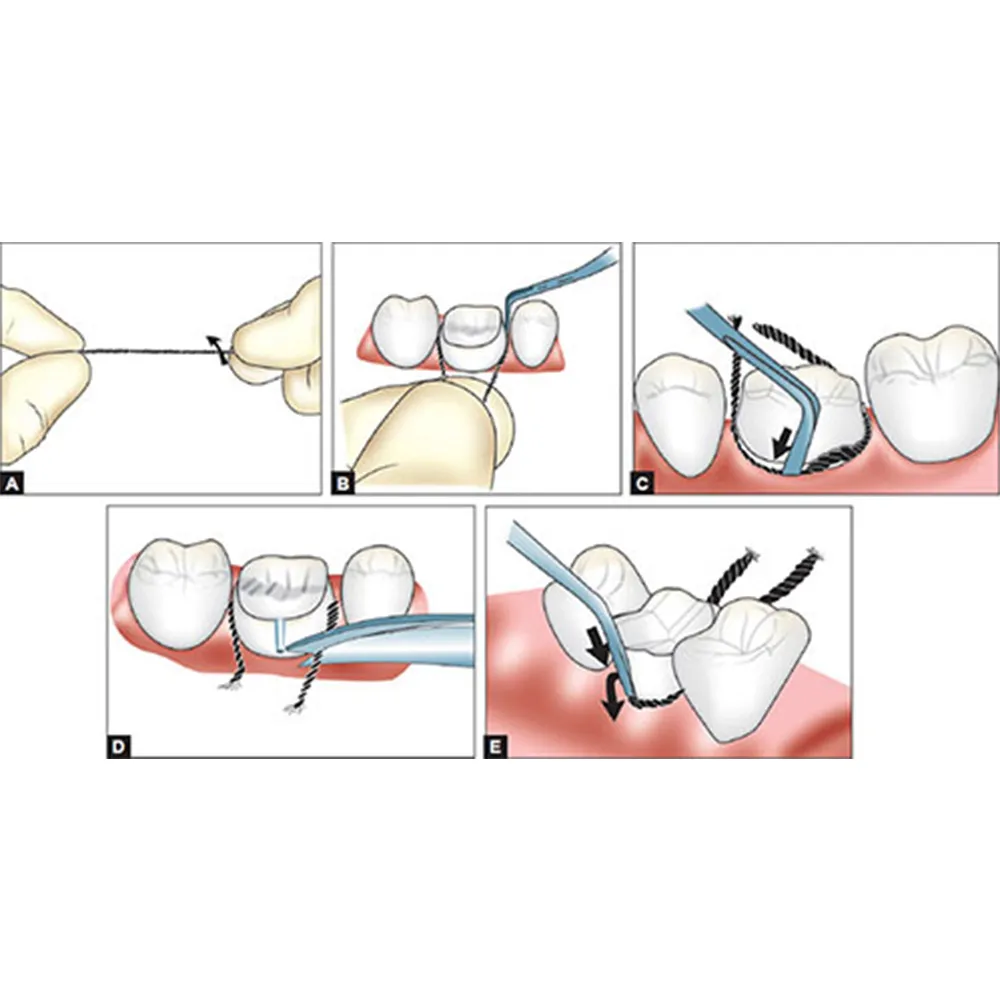 Coltene Roeko Stay-Put Retraction Cords
