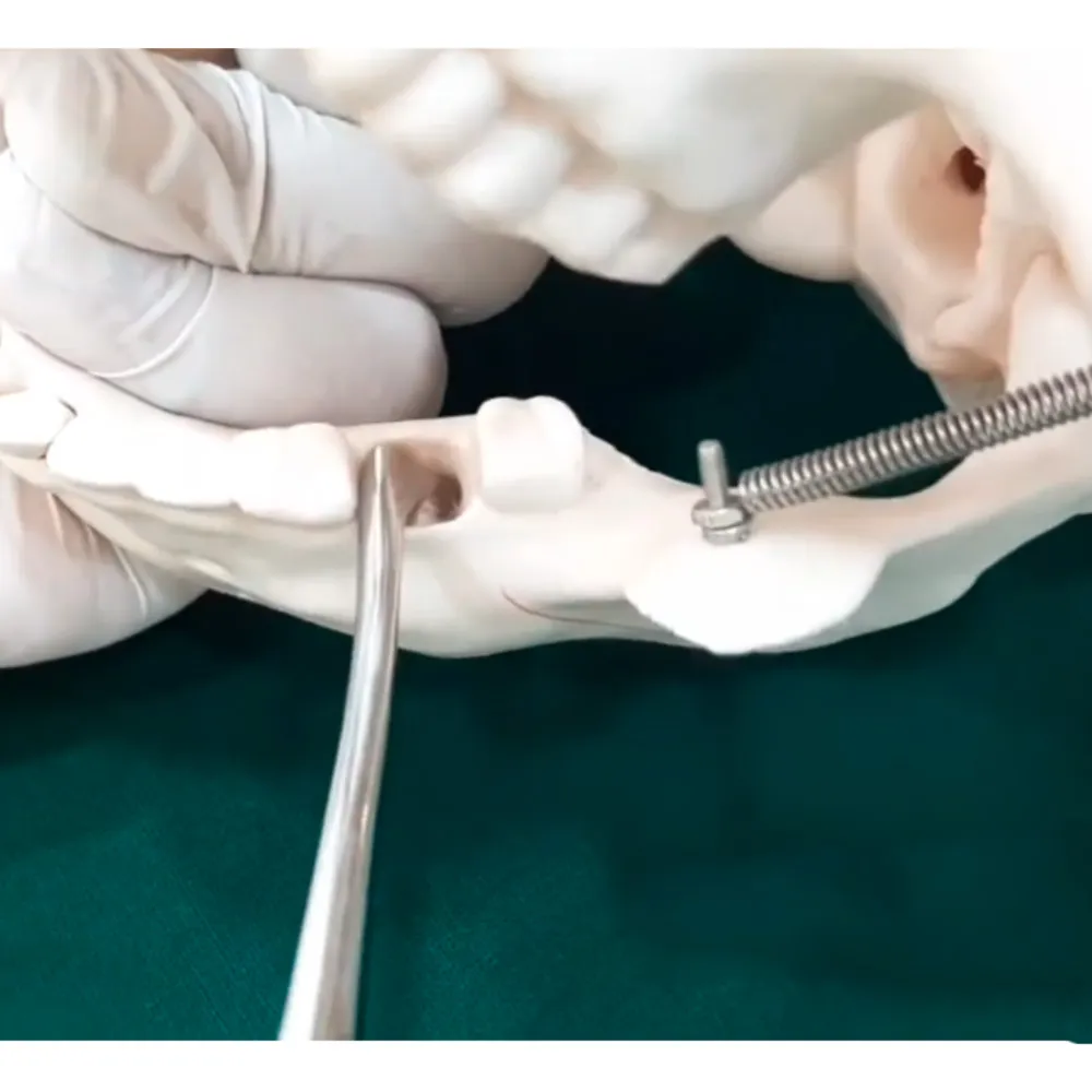 Oracraft Winter Cryer Crossbar Root Elevator