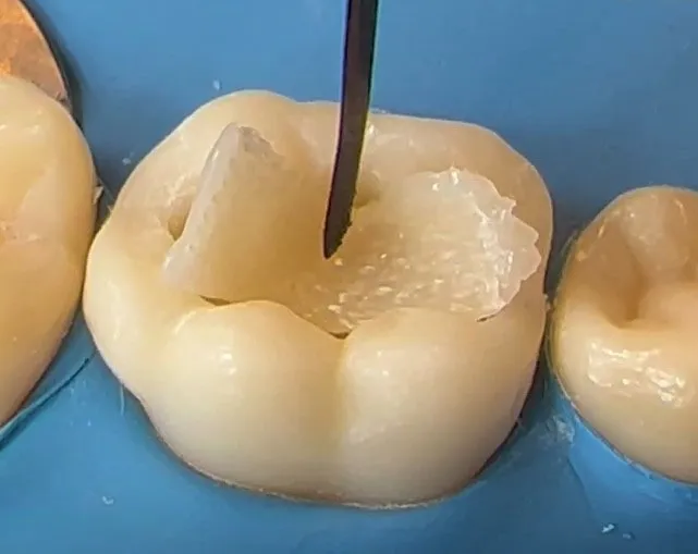 Ribbond Ribbon Fiber Splint Buy Online at Best Price | Dentalkart