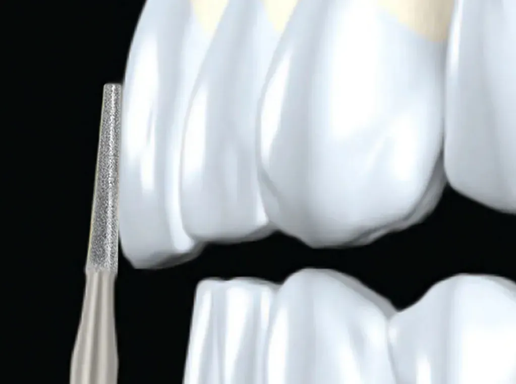 Mani Diamond Burs - Taper Flat End / Tf Series | DentalKart