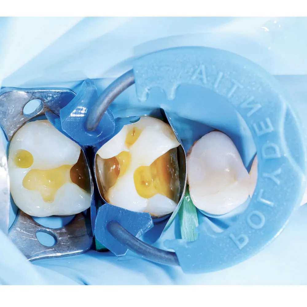 Polydentia Diamond24 Silicone Tubes For MyRing Classico