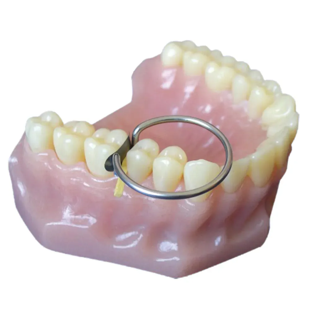 Buy Russia Tor VM Dental Rings | VM Rings for Superior Contac