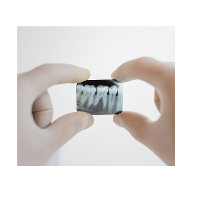 Buy E-Speed Dental X-Ray Film: with Optimal IOPA Film Size & Low ...