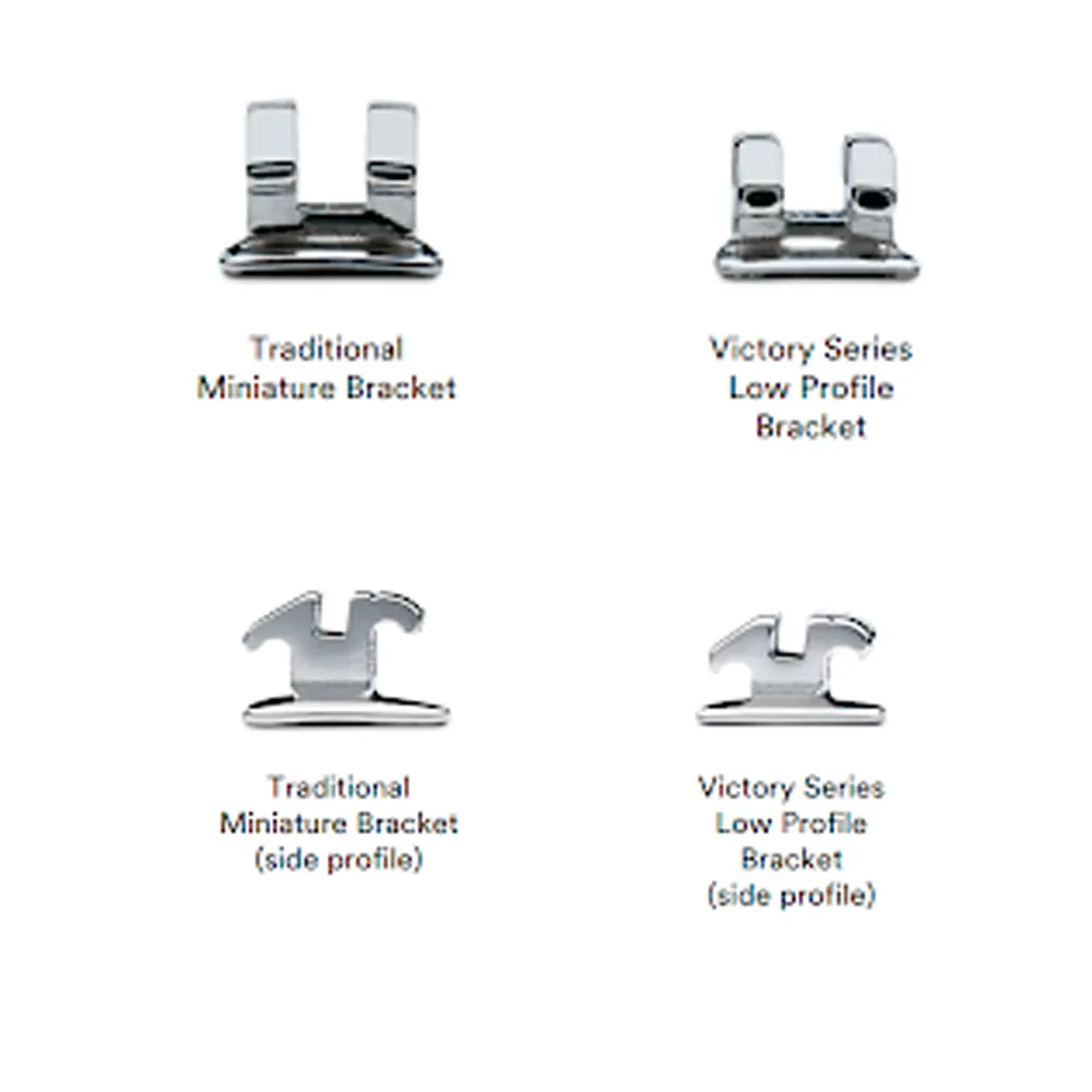 3m Unitek Victory Series Low Profile Brackets:Sleek Low-Profile ...