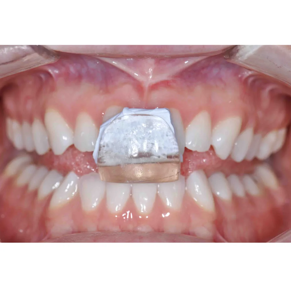 Maarc Eazy Tray 100gm