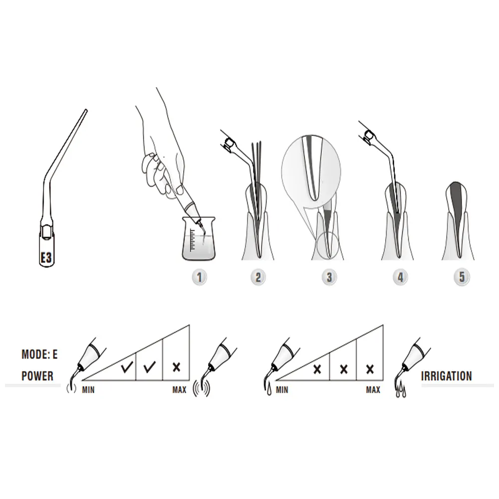 Woodpecker Endodontic Scaler Tips for UDS & EMS Scalers