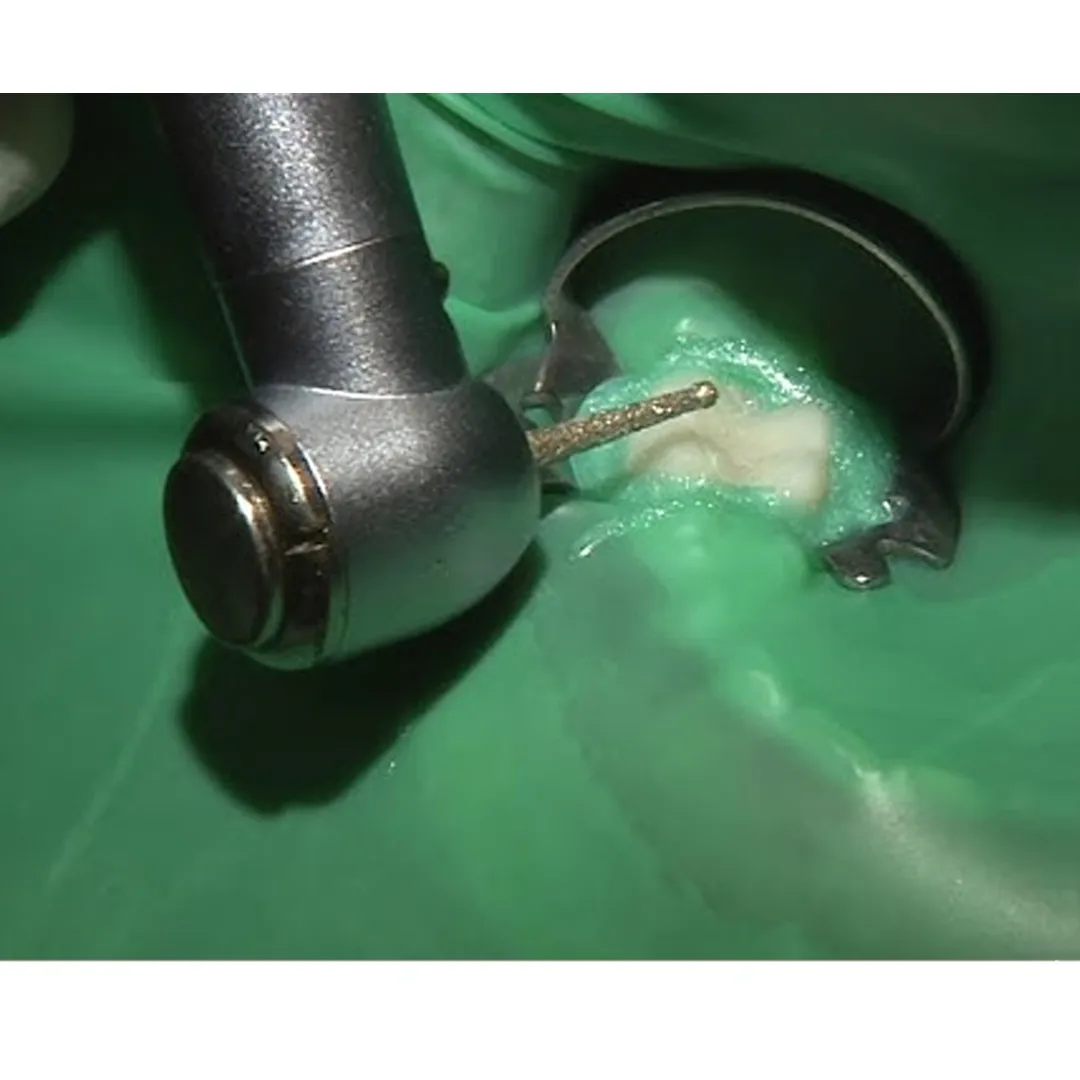 Superendo Endo Access Bur - 12