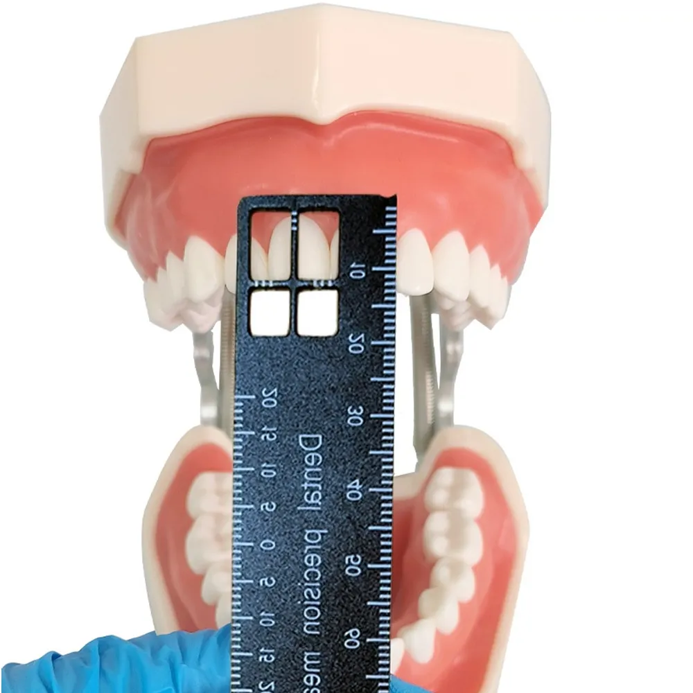 ET Dental Precision Measuring Ruler Online at Best Price | Dentalkart.com