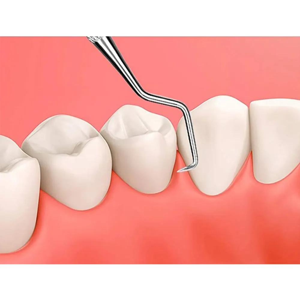 GDC Probe Explorer - Double Ended -4 (Exd5) Online at Best Price ...