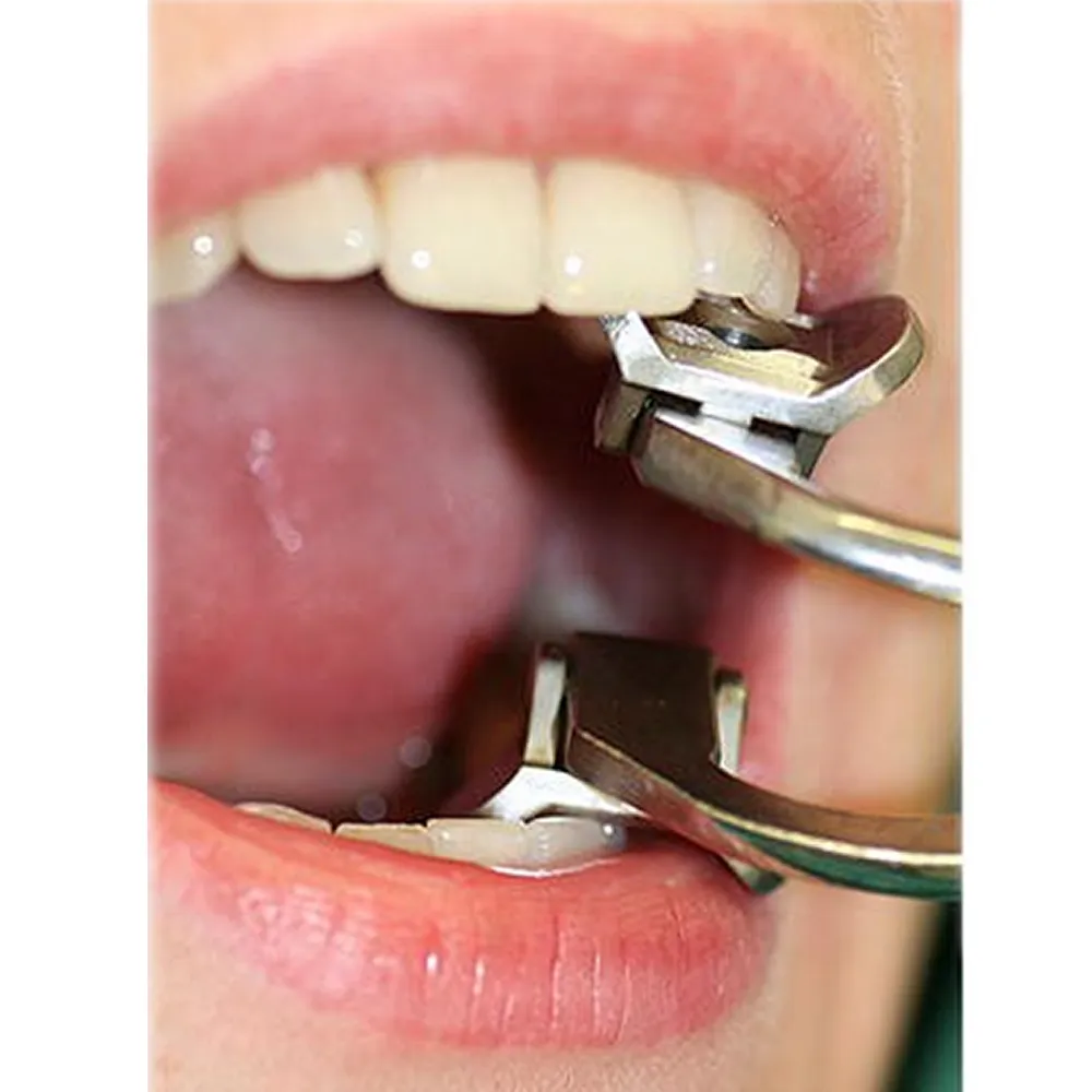 Buy GDC Ferguson Mouth Gag Online At Best Price On Dentalkart